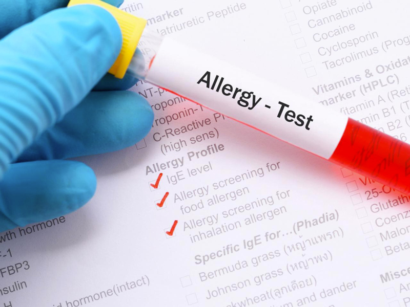 Аналізи на алергію: панель на алергени ️ Медсоюз